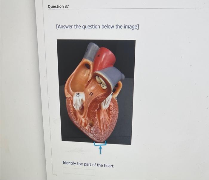 Solved [Answer the question below the image] Identify the | Chegg.com