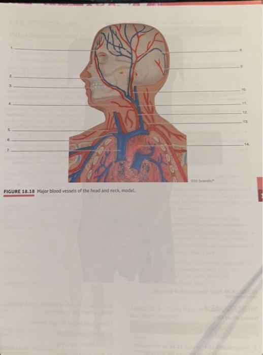 Solved 5. FIGURE 18.18 Major blood vessels of the head and | Chegg.com