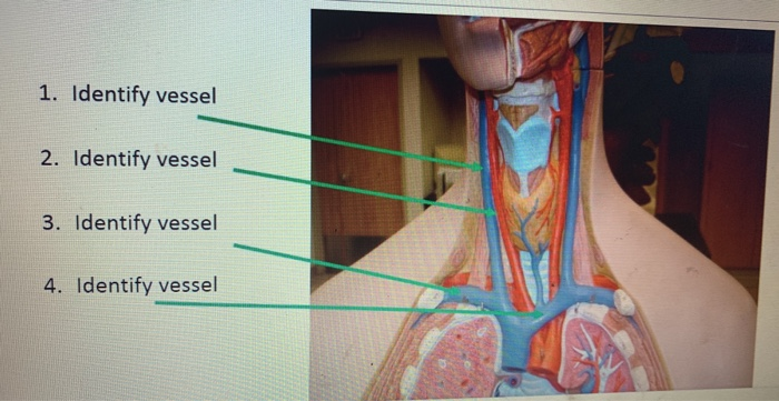 Solved 1. Identify vessel 2. Identify vessel 3. Identify | Chegg.com