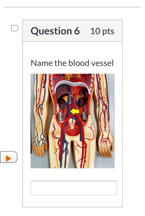 Solved Question 1 10 pts Name this blood vessel (in red) D | Chegg.com