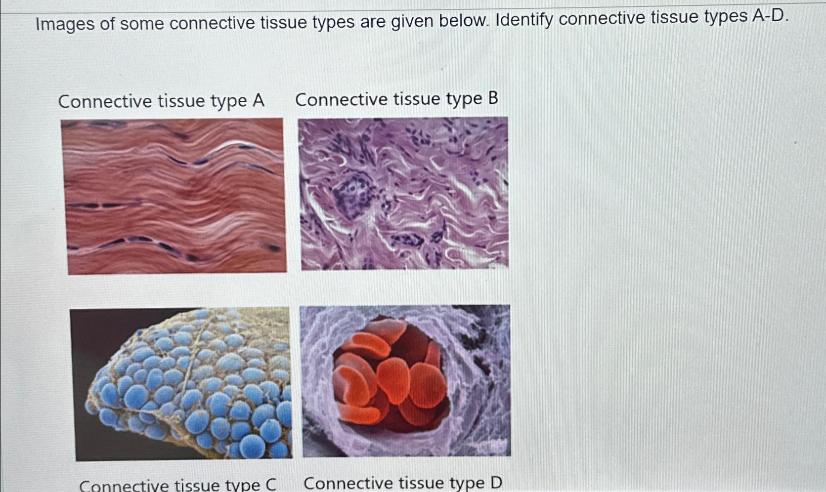 Solved Images of some connective tissue types are given | Chegg.com