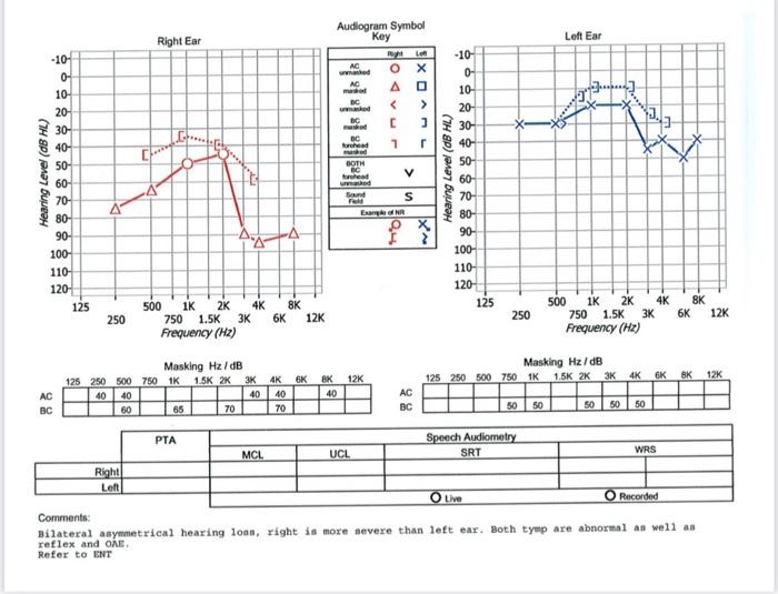Solved Audiogram Symbol Key Right Ear Loft Ear X -10- 0- 10- | Chegg.com