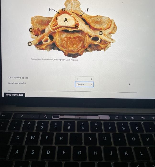 Solved H F А B D Dissection Shawn Miller, Photograph Mark | Chegg.com