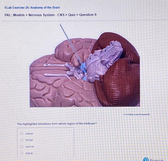 Solved Nervous System: CNS > Quiz > Question 19 Which | Chegg.com