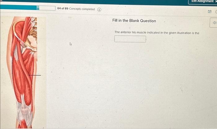 Solved The anterior his muscle indicated in the given | Chegg.com