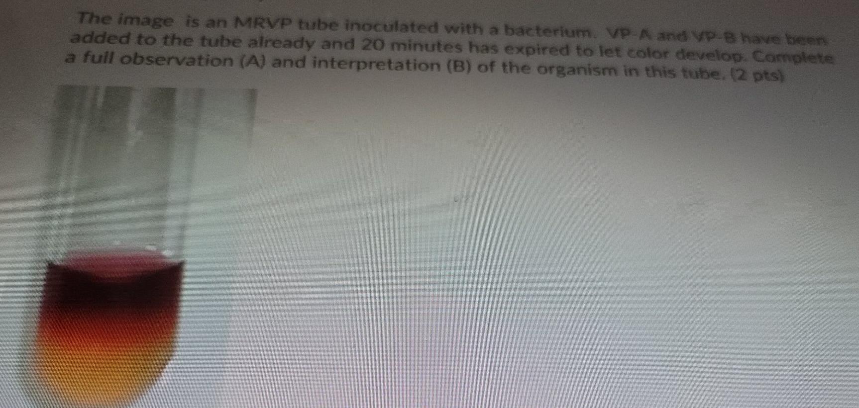 Solved The image is an MRVP tube inoculated with a | Chegg.com
