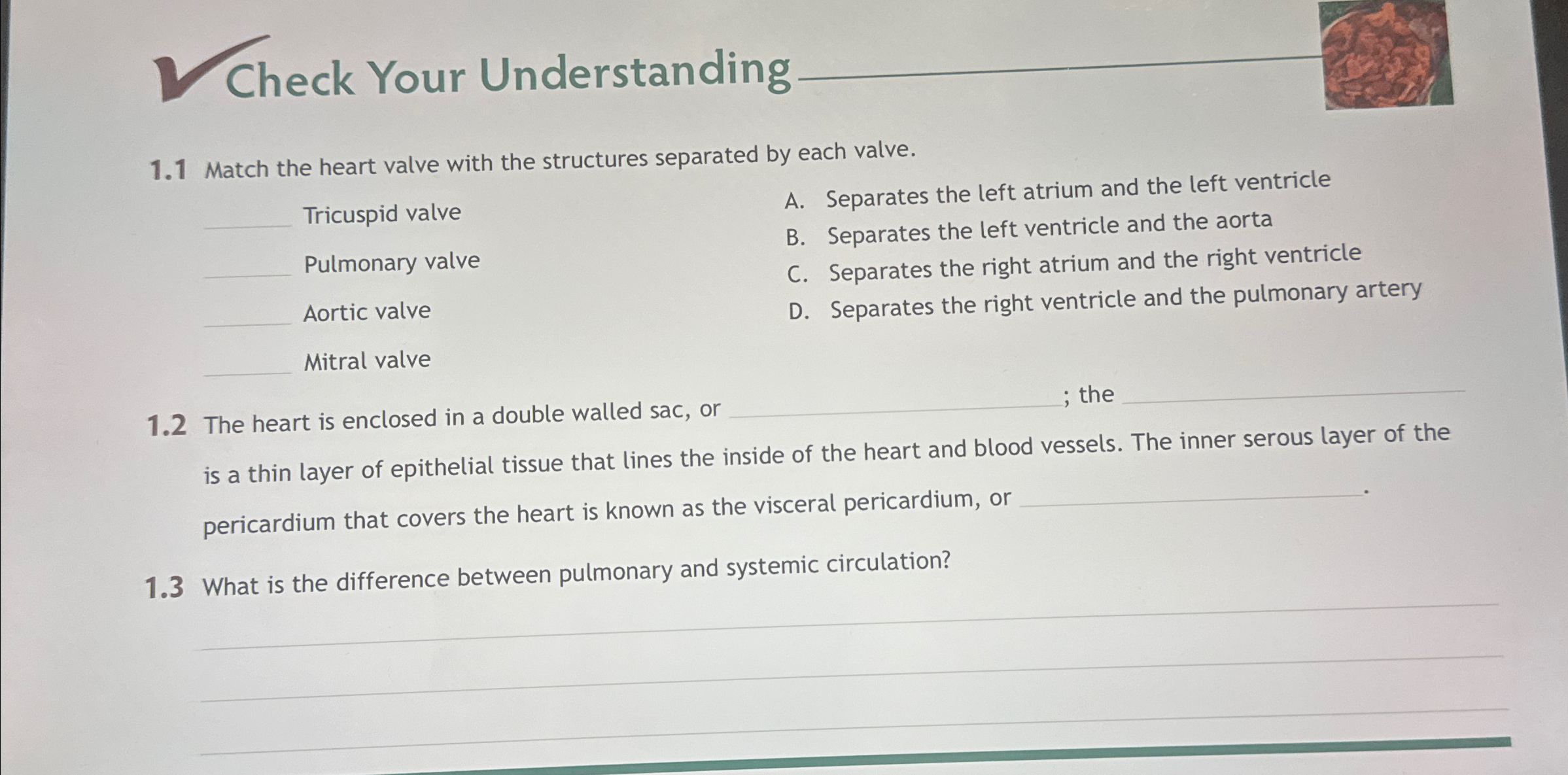 Solved Check Your Understanding1.1 ﻿Match the heart valve | Chegg.com