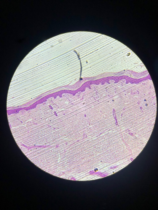 Solved Integumentary System Section Labeling 1. Label the | Chegg.com