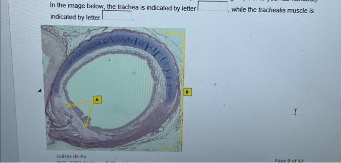 Solved In the image below, the trachea is indicated by | Chegg.com
