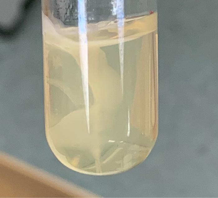 Solved Motility Test Would this be considered Motile or | Chegg.com