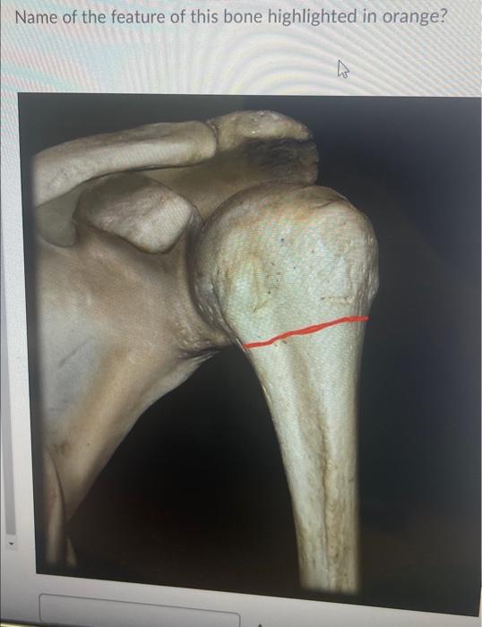 Solved Name of the feature of this bone highlighted in | Chegg.com
