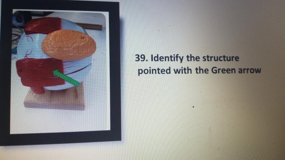 Solved ਬਰ- 36. Identify the structure pointed with the Red | Chegg.com