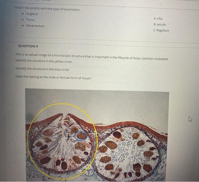 Solved Match the protist with the type of locomotion. | Chegg.com