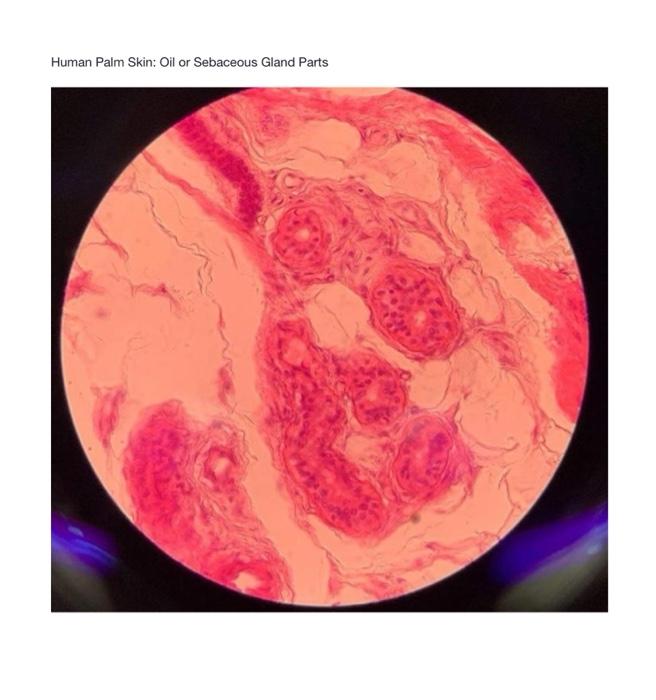 Solved Identify the parts of the Sebaceous Gland in the | Chegg.com