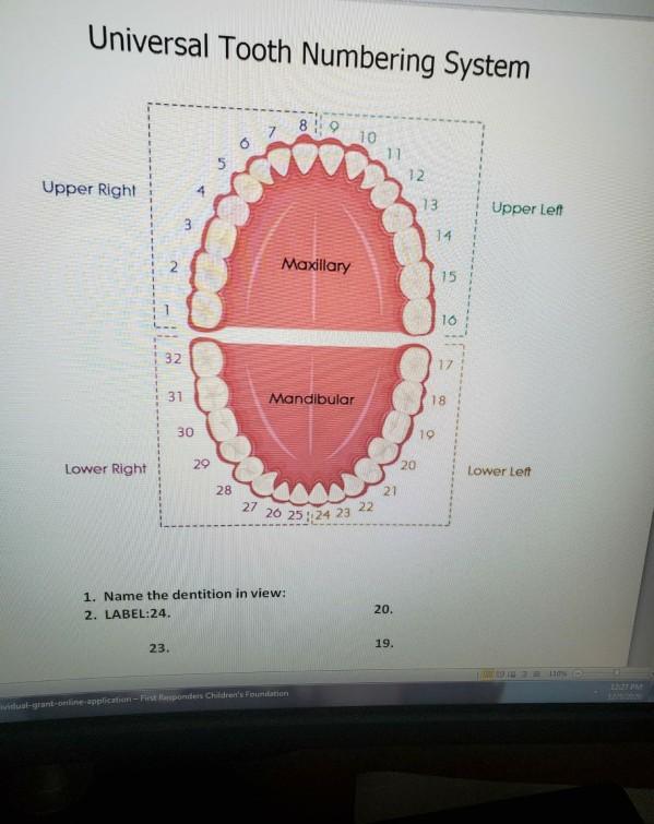 Solved 27 26 25 24 23 Universal Tooth Numbering System 7 10 | Chegg.com