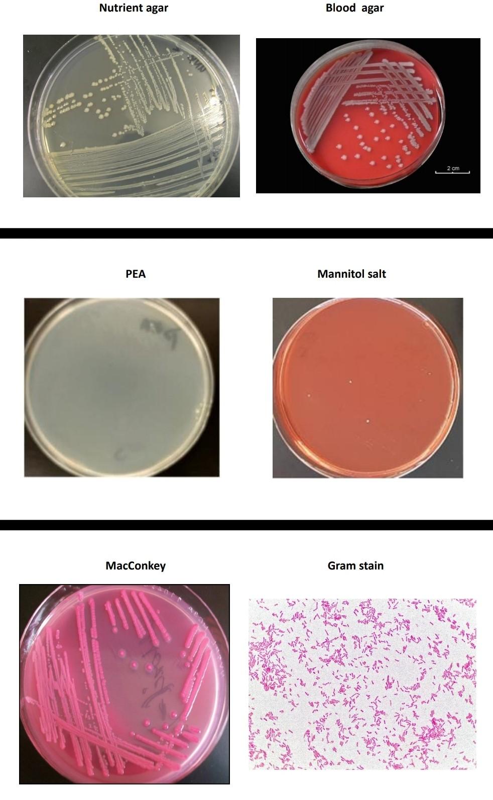 Solved Nutrient agar Blood agar S** 2 cm PEA Mannitol salt | Chegg.com