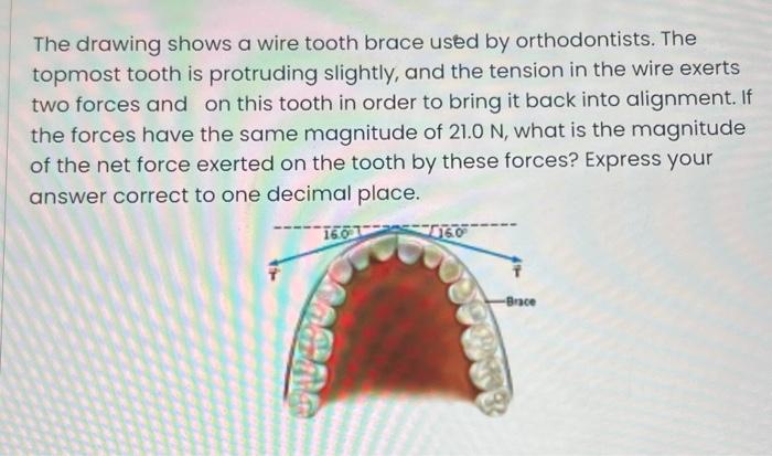 Solved The drawing shows a wire tooth brace used by | Chegg.com