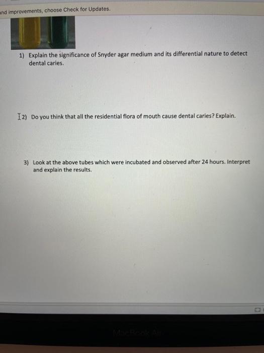 Solved SNYDER TEST - Caries Susceptibility Testing-(Mouth | Chegg.com