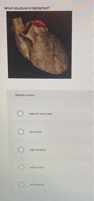 Solved Which structure is highlighted? Multiple Choice O | Chegg.com