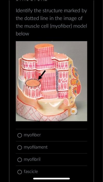 Solved Identify the structure marked by the dotted line in | Chegg.com