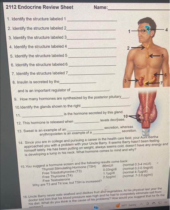 Solved 2112 Endocrine Review Sheet Name: 1. Identify the | Chegg.com