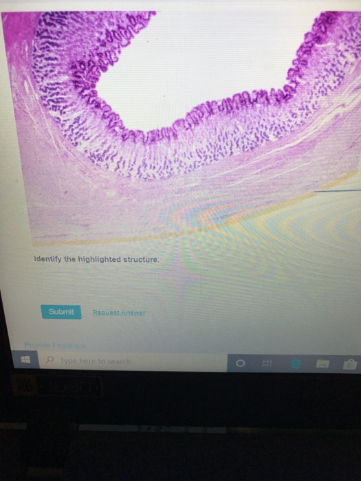 Solved VEPLAN Identify the highlighted structure. Submit | Chegg.com