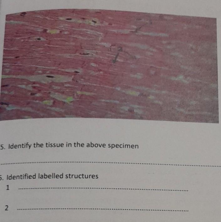 Solved 5. Identify the tissue in the above specimen 5. | Chegg.com