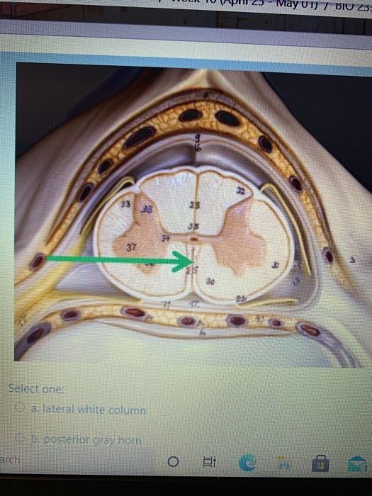 Solved UT) 7 BIO 25 25 34 37 217 30 Select one: a lateral | Chegg.com