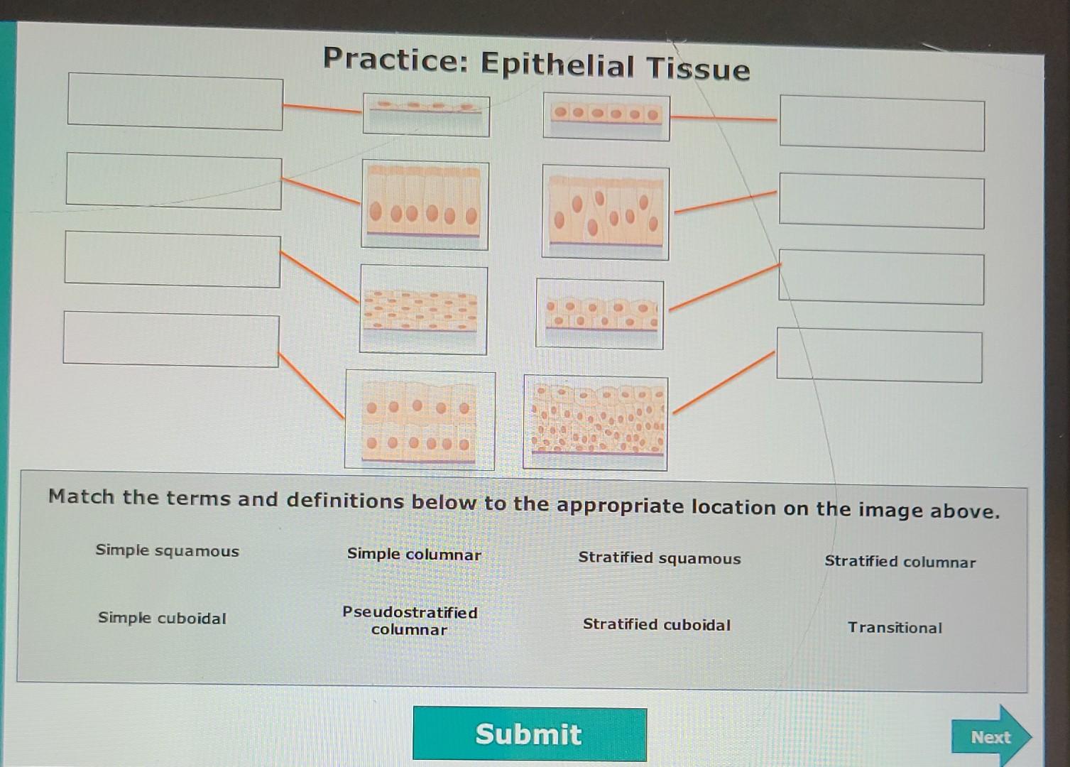 Solved Match the terms and definitions below to the | Chegg.com