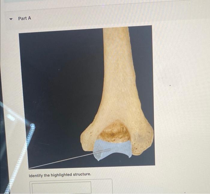 Solved Y Part A 健 Identify the highlighted bones. Identify | Chegg.com