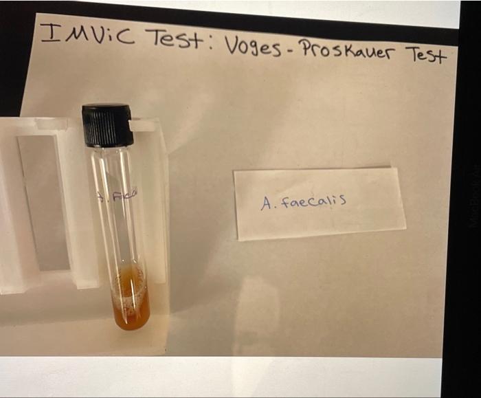 Solved PART B: Methyl Red Test and Voges-Proskauer Test | Chegg.com