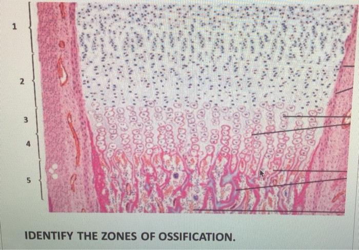 Solved IDENTIFY TYPE OF BONE. IDENTIFY POINTED STRUCTURE. | Chegg.com Solved IDENTIFY TYPE OF BONE. IDENTIFY POINTED STRUCTURE. | Chegg.com