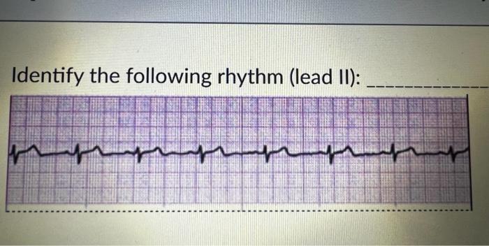 Solved Identify the following rhythm (lead II): | Chegg.com