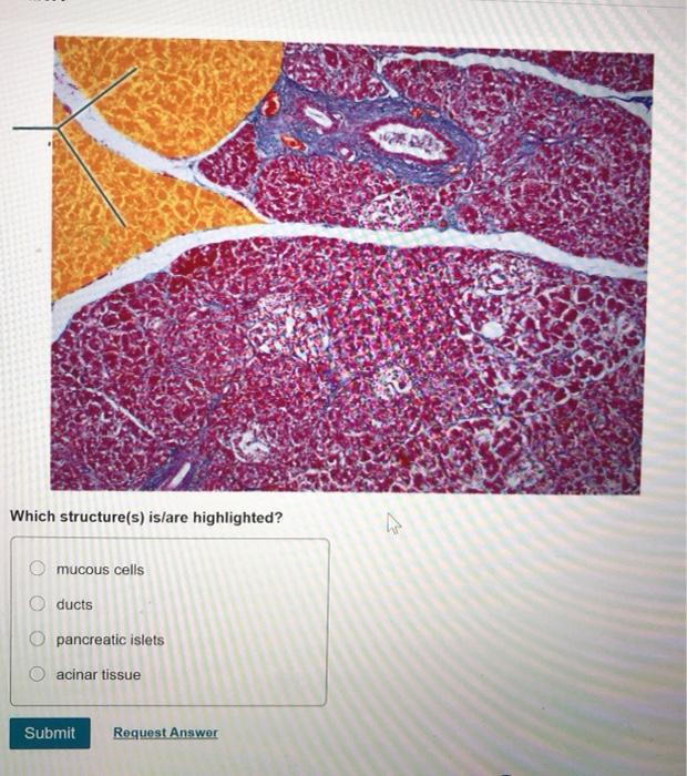 Solved Which structure(s) is/are highlighted? mucous cells | Chegg.com