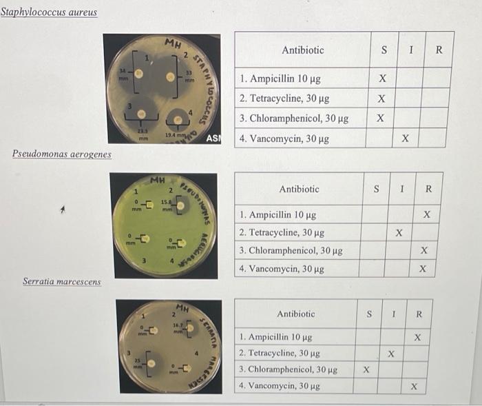Solved 3. Which antibiotics demonstrate the broadest range | Chegg.com