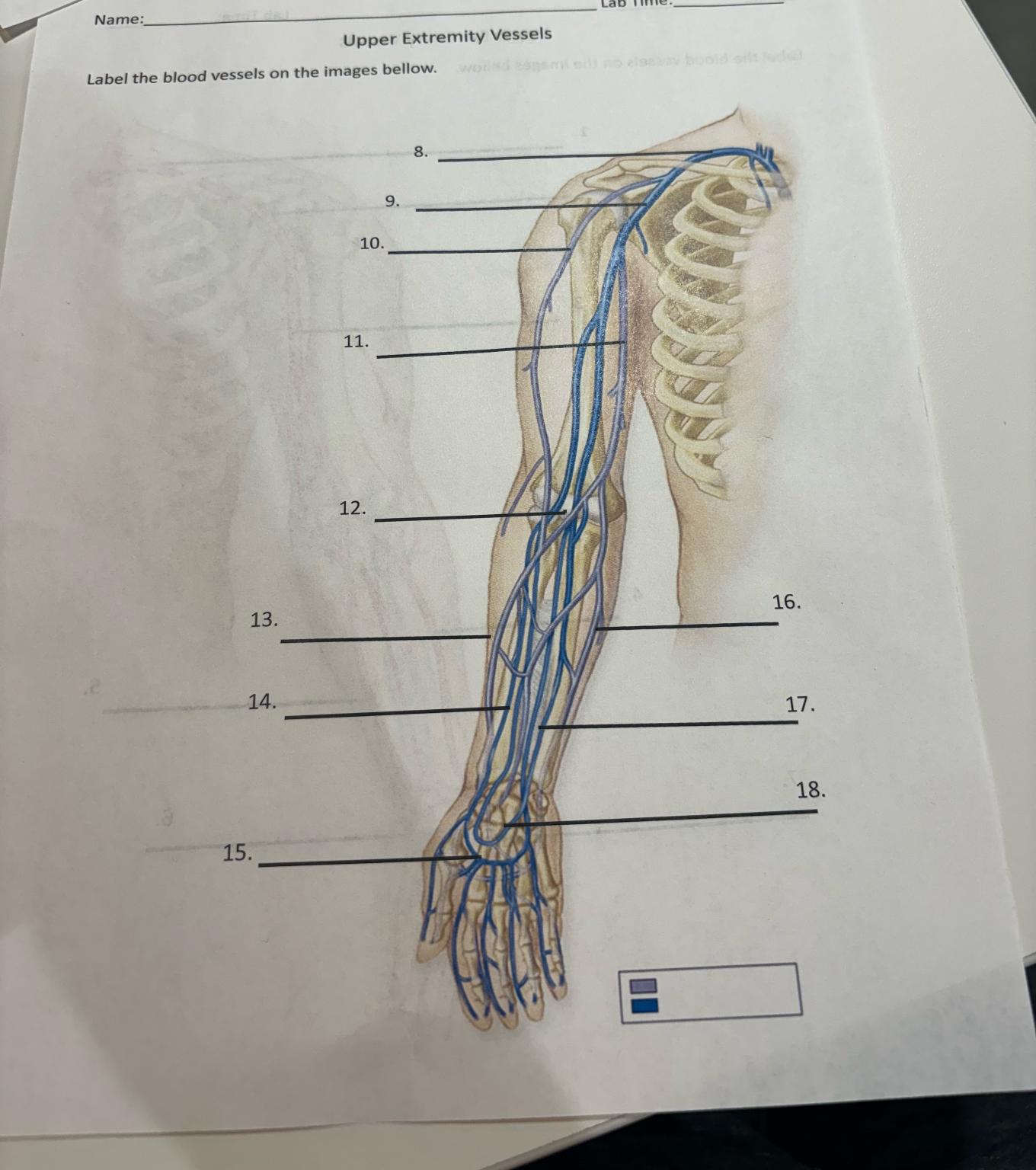 Solved Name:Upper Extremity VesselsLabel the blood vessels | Chegg.com
