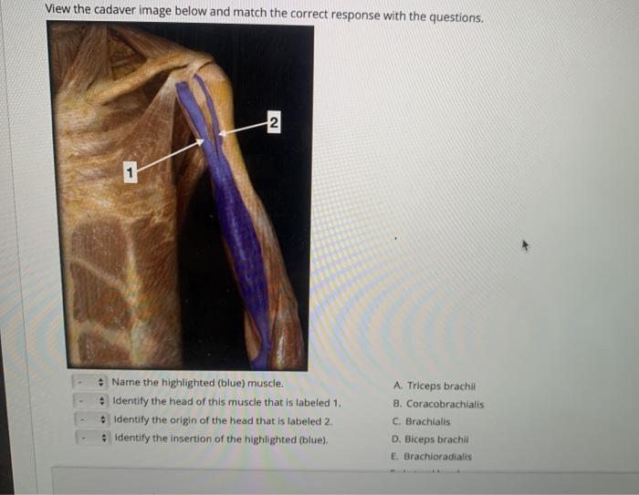 Solved View the cadaver image below and match the correct | Chegg.com