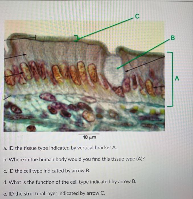 Solved С B DAN W A 10 um a. ID the tissue type indicated by | Chegg.com