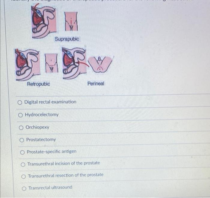 Solved Suprapubic Retropubic Perineal O Digital rectal | Chegg.com