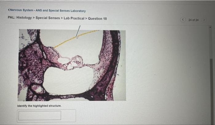 Solved \&Nervous System - ANS and Special Senses Laboratory | Chegg.com Solved \&Nervous System - ANS and Special Senses Laboratory | Chegg.com