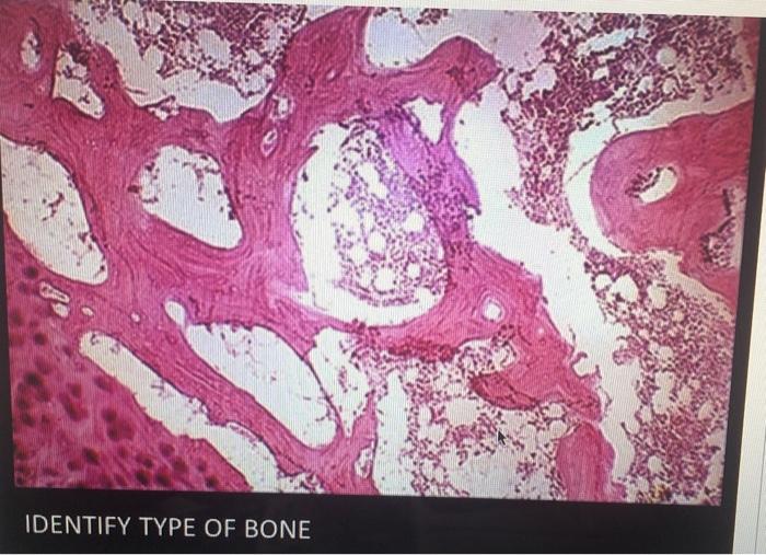 Solved IDENTIFY TYPE OF BONE. IDENTIFY POINTED STRUCTURE. | Chegg.com Solved IDENTIFY TYPE OF BONE. IDENTIFY POINTED STRUCTURE. | Chegg.com