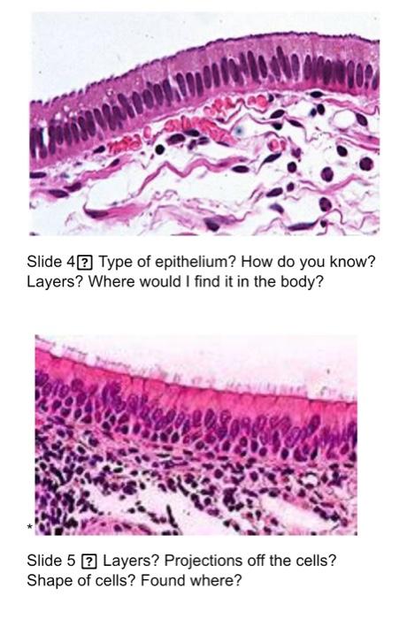 Solved Slide 3→ Type of epithelium? Layers? Where would I | Chegg.com