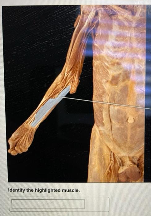 Solved Identify the highlighted muscle. The highlighted | Chegg.com Solved Identify the highlighted muscle. The highlighted | Chegg.com