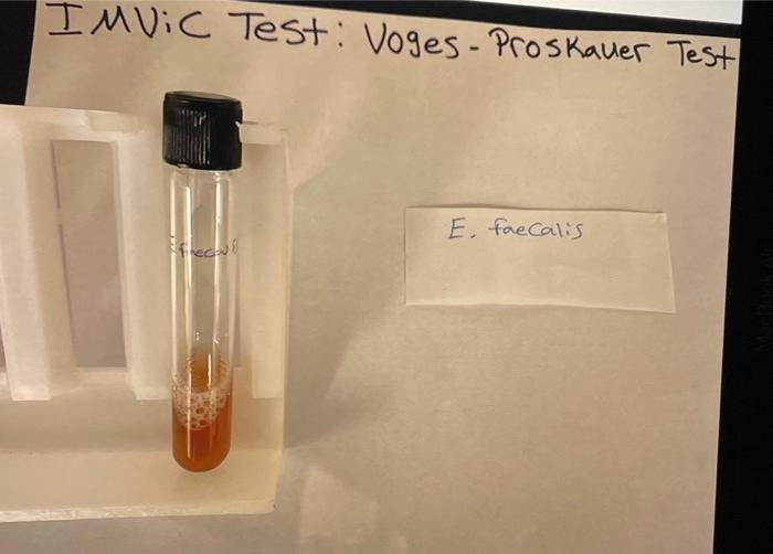 Solved PART B: Methyl Red Test and Voges-Proskauer Test | Chegg.com