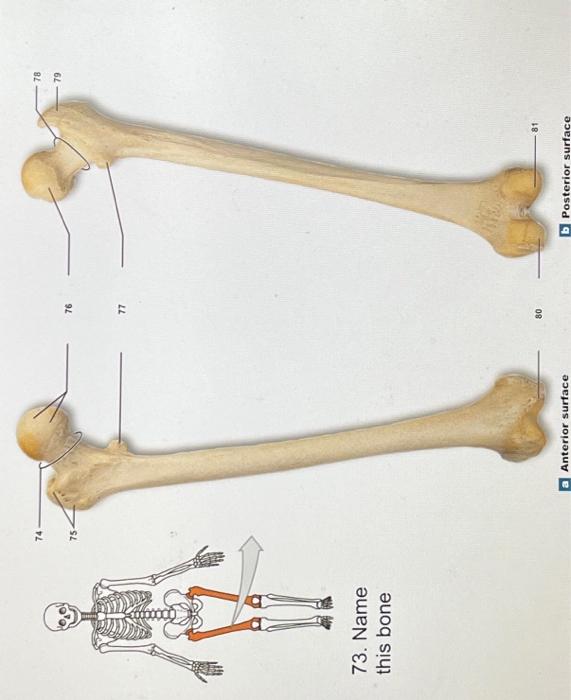 Solved 73. Name this bone | Chegg.com