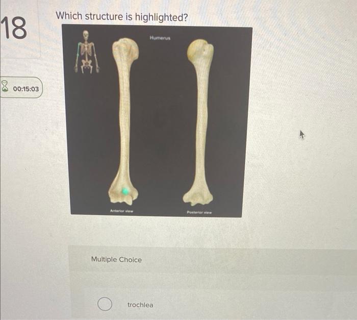 Solved Which structure is highlighted? Multiple Choice | Chegg.com