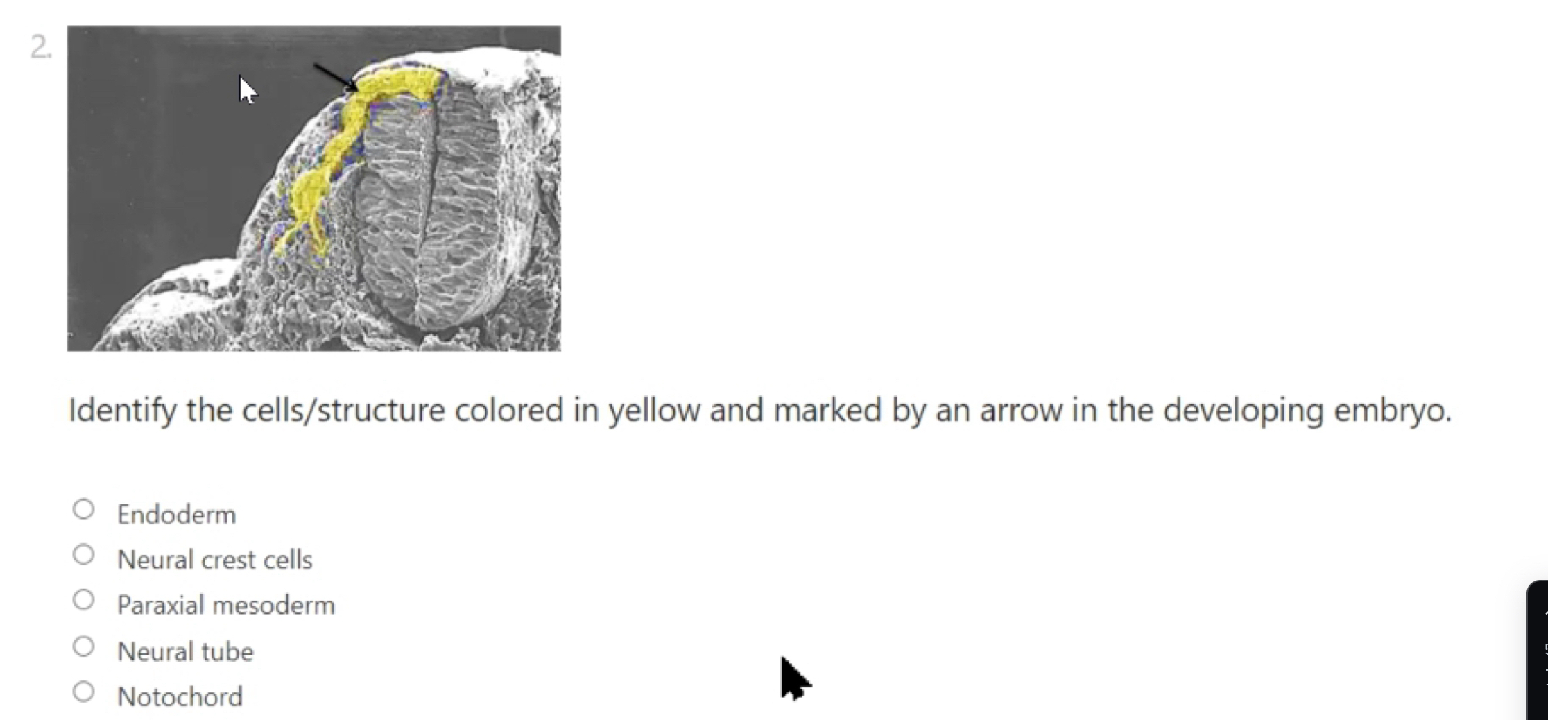 Solved Identify the cells/structure colored in yellow and | Chegg.com