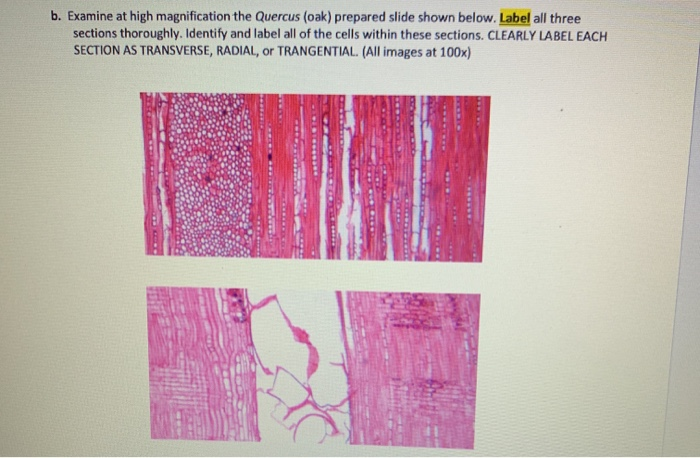 Solved b. Examine at high magnification the Quercus (oak) | Chegg.com