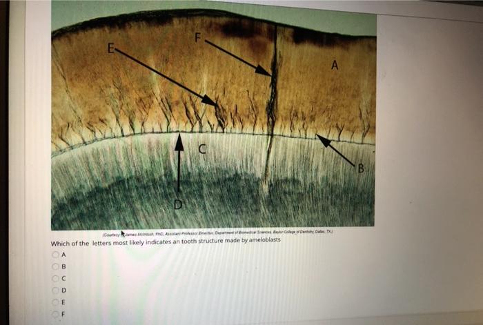 Solved А ICP Which of the letters most likely indicates an | Chegg.com