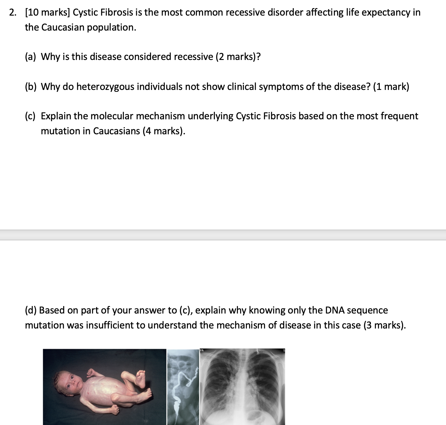 Solved [10 ﻿marks] ﻿Cystic Fibrosis is the most common | Chegg.com